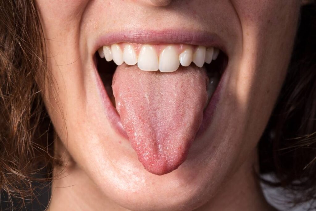Tiny Bumps on Your Tongue: Causes, Signs & Care Tips